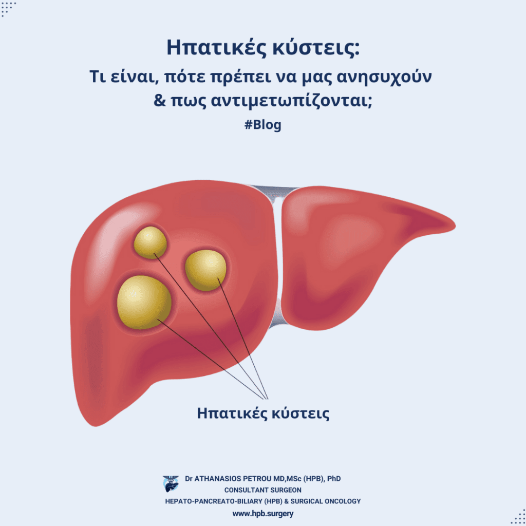 Hπατικές κύστεις: Τι είναι, πότε πρέπει να μας ανησυχούν & πως ...